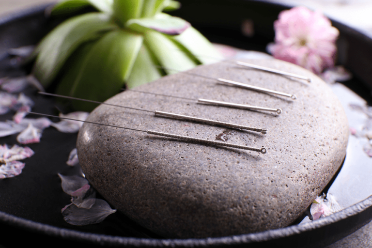 Apex Physiotherapy & Chiropractic, ON, Pickering - Physiotherapy ...
