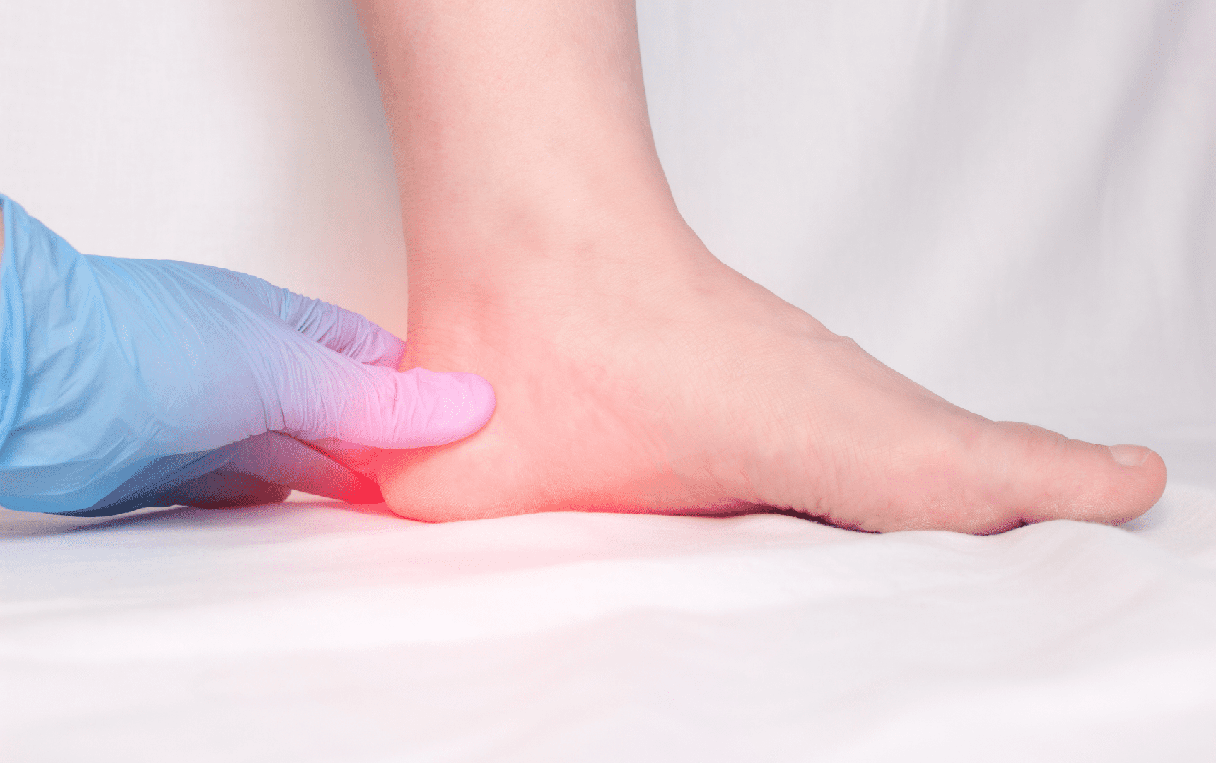 The Connection Between Plantar Fasciitis and Custom Orthotics